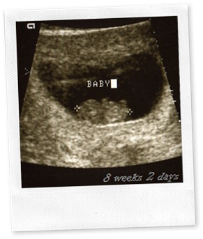 Jessica & John: Our Little Miracle!